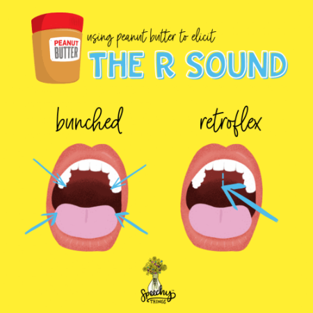 5 Ways You Can Use Food to Elicit The R Sound in Speech Therapy • Rock ...